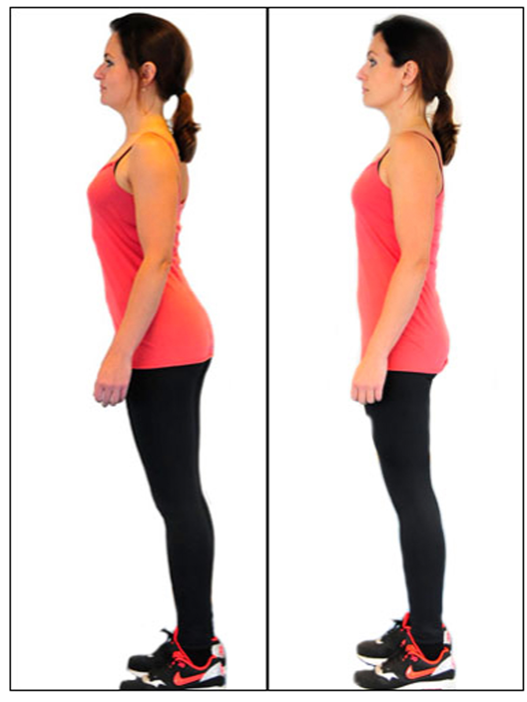 Have you got Donald Duck Back? - Emsworth Physio Clinic